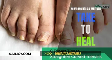 Toe Nail Trauma: Bruising And Recovery Time | Nailicy