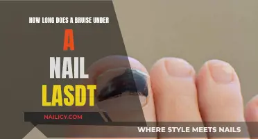 Healing Cut Nails: Time And Tips To Recover | Nailicy