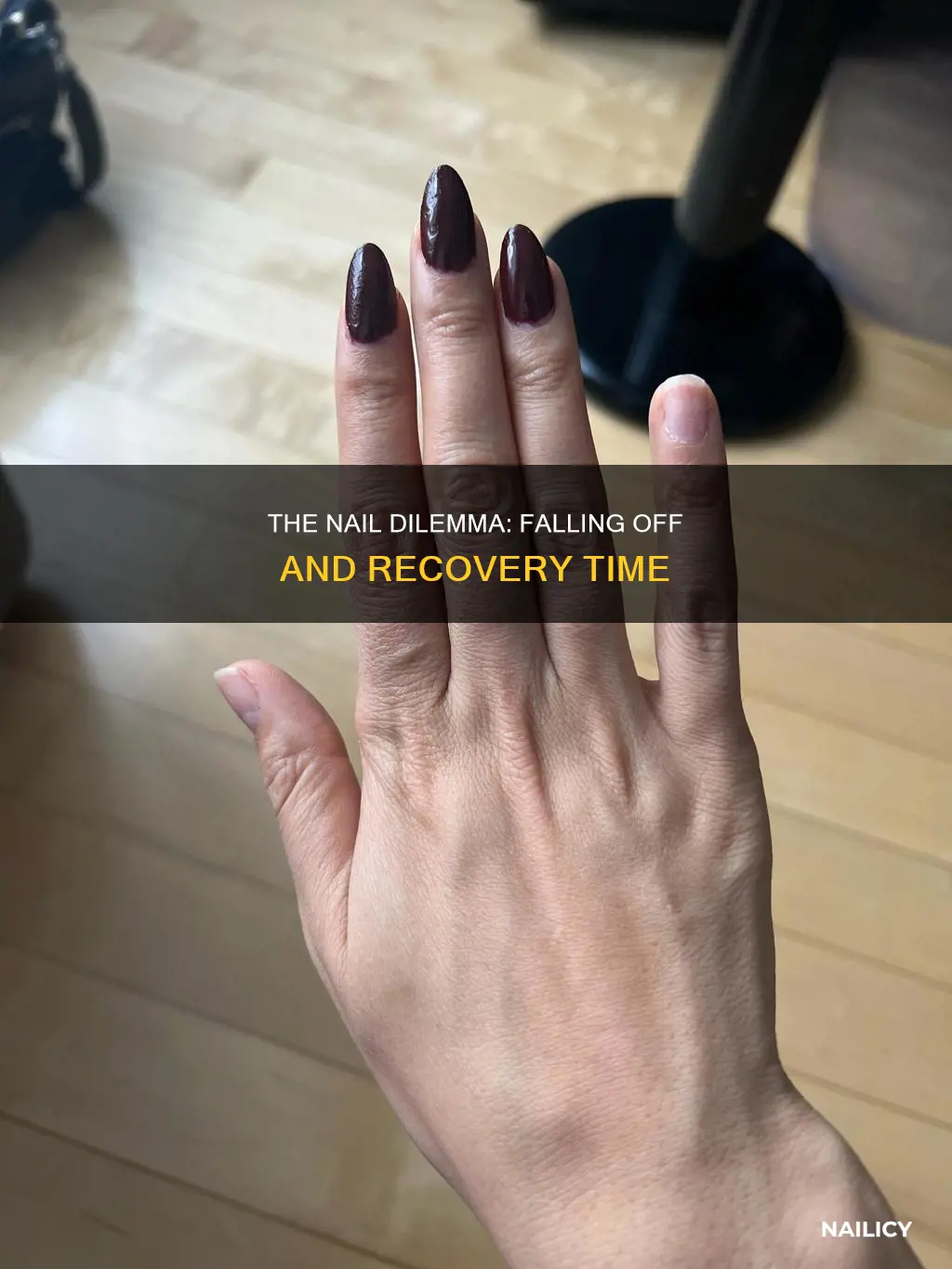 The Nail Dilemma: Falling Off And Recovery Time | Nailicy