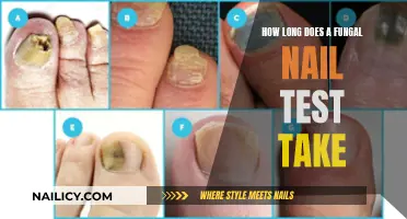 Nail Bed Testing: How Far Back Can It Go? | Nailicy