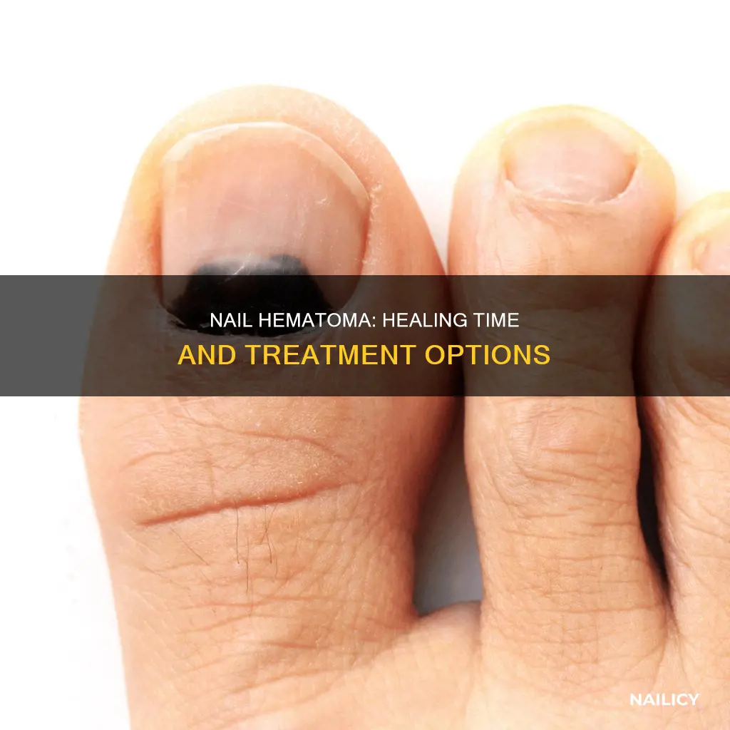 Nail Hematoma: Healing Time And Treatment Options | Nailicy