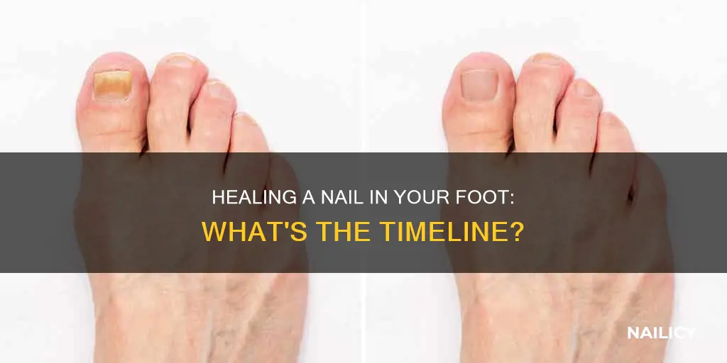 Healing A Nail In Your Foot: What's The Timeline? | Nailicy