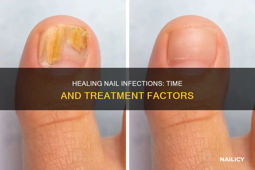 Healing Nail Infections: Time And Treatment Factors | Nailicy
