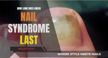 Healing An Ingrown Toenail: What's The Timeline? | Nailicy