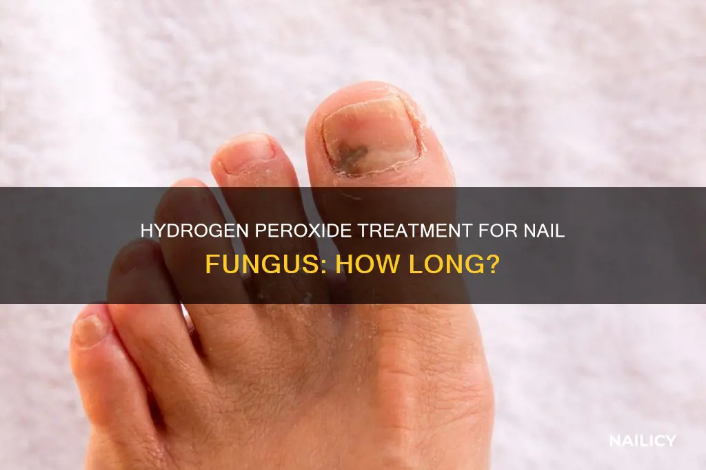 Hydrogen Peroxide Treatment For Nail Fungus: How Long? | Nailicy
