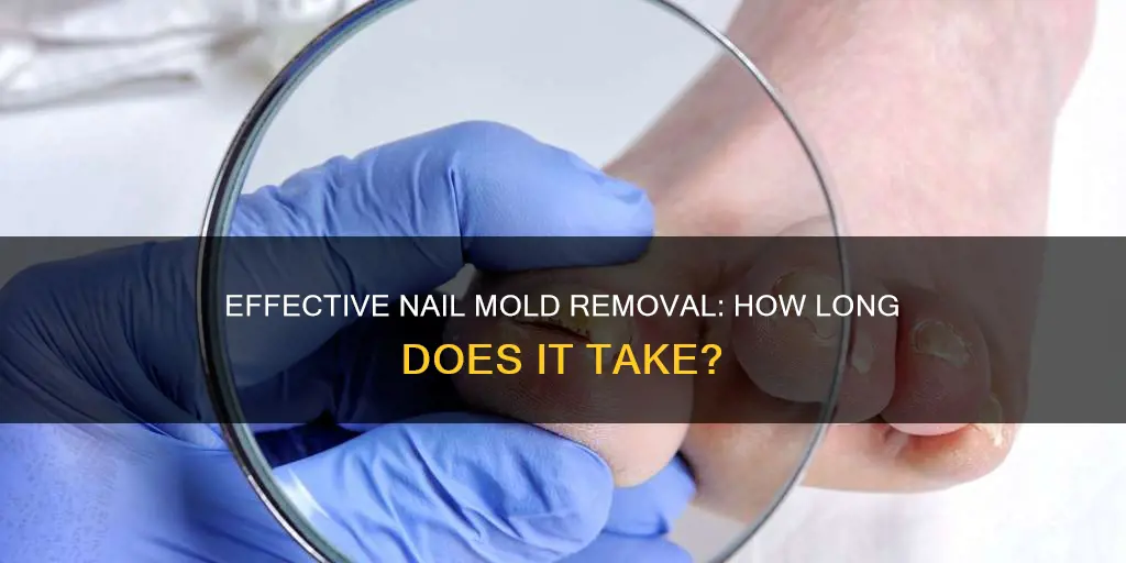 Effective Nail Mold Removal: How Long Does It Take? | Nailicy