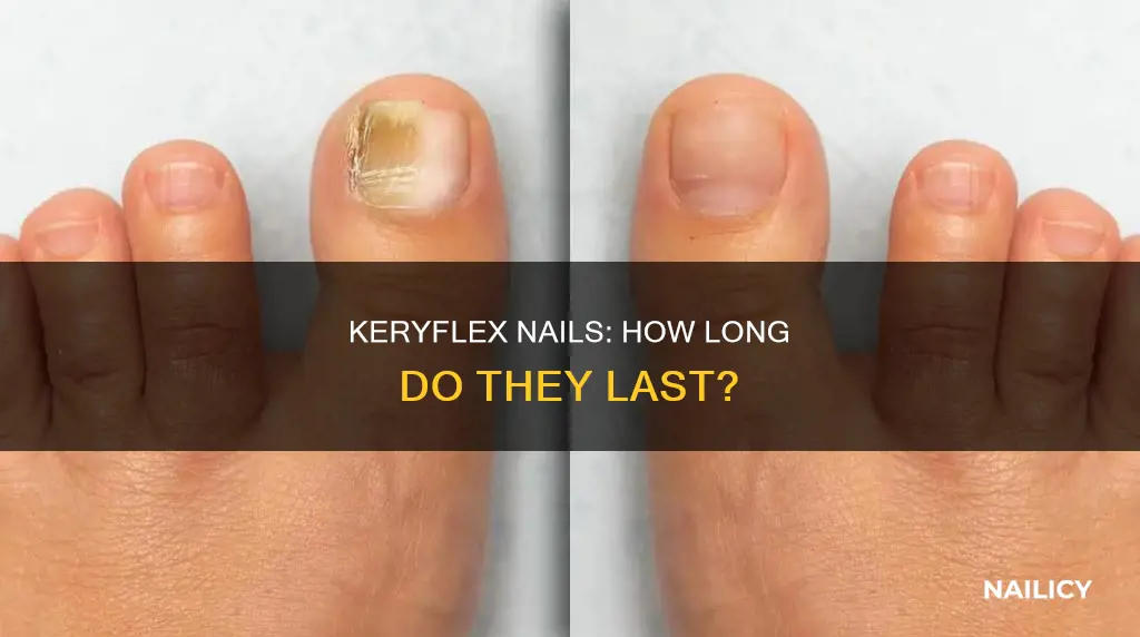 Keryflex Nails: How Long Do They Last? | Nailicy