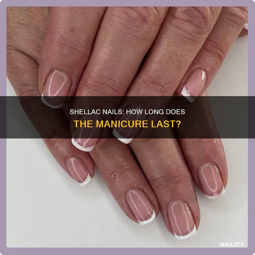 Shellac Nails: How Long Does The Manicure Last? | Nailicy