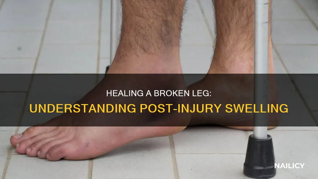 Healing A Broken Leg: Understanding Post-Injury Swelling | Nailicy
