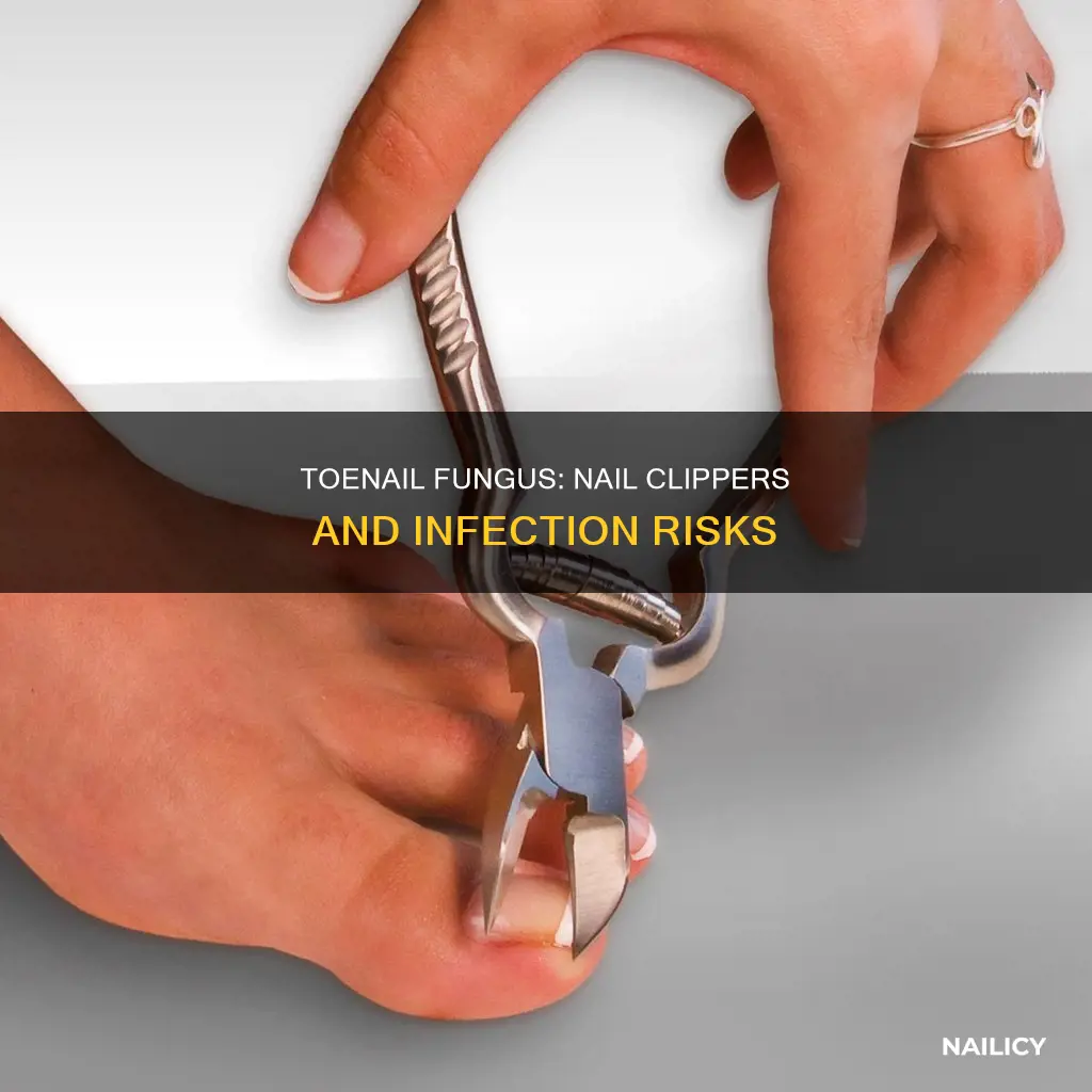 Toenail Fungus: Nail Clippers And Infection Risks | Nailicy