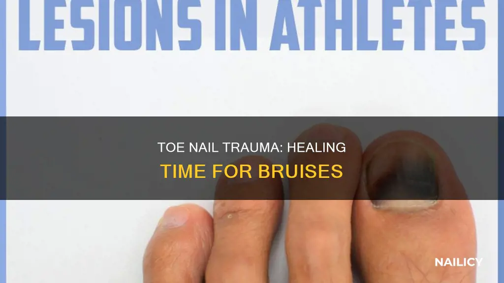 Toe Nail Trauma: Healing Time For Bruises | Nailicy