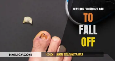 Healing Time: Smashed Nails And What To Expect | Nailicy