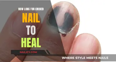 Healing Time: Smashed Nails And What To Expect | Nailicy
