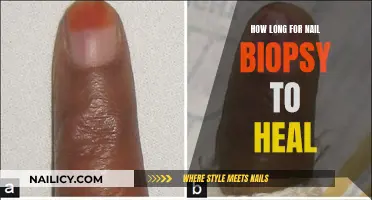 Healing Nails: Time To Recover And What To Expect | Nailicy