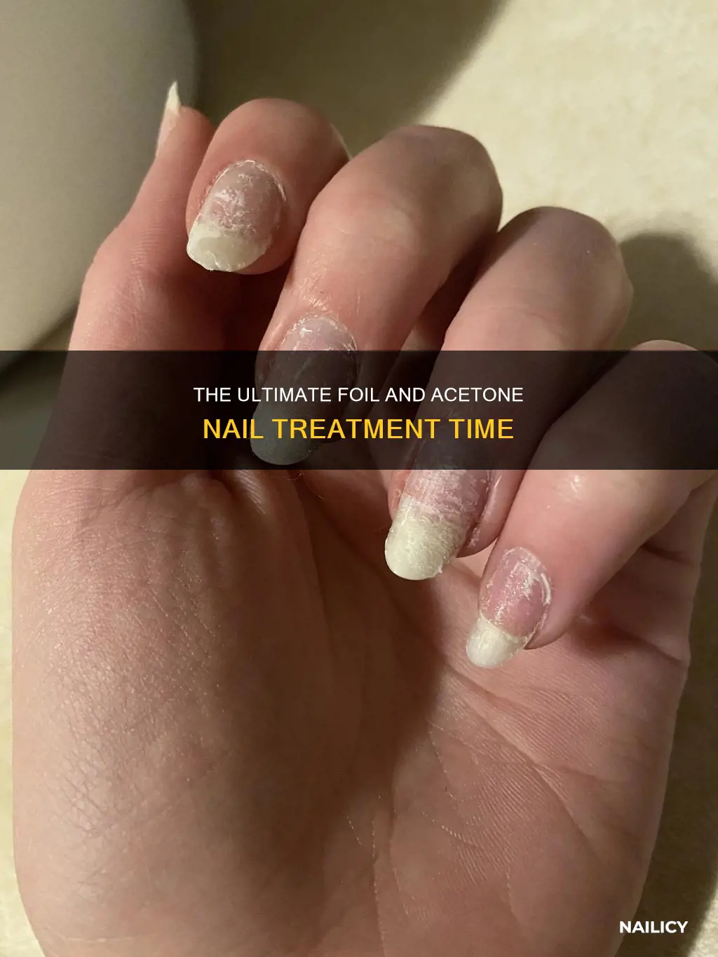 The Ultimate Foil And Acetone Nail Treatment Time | Nailicy