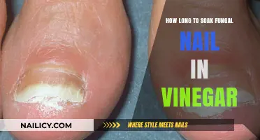 Soaking Injured Toenails: How Long Is Too Long? | Nailicy