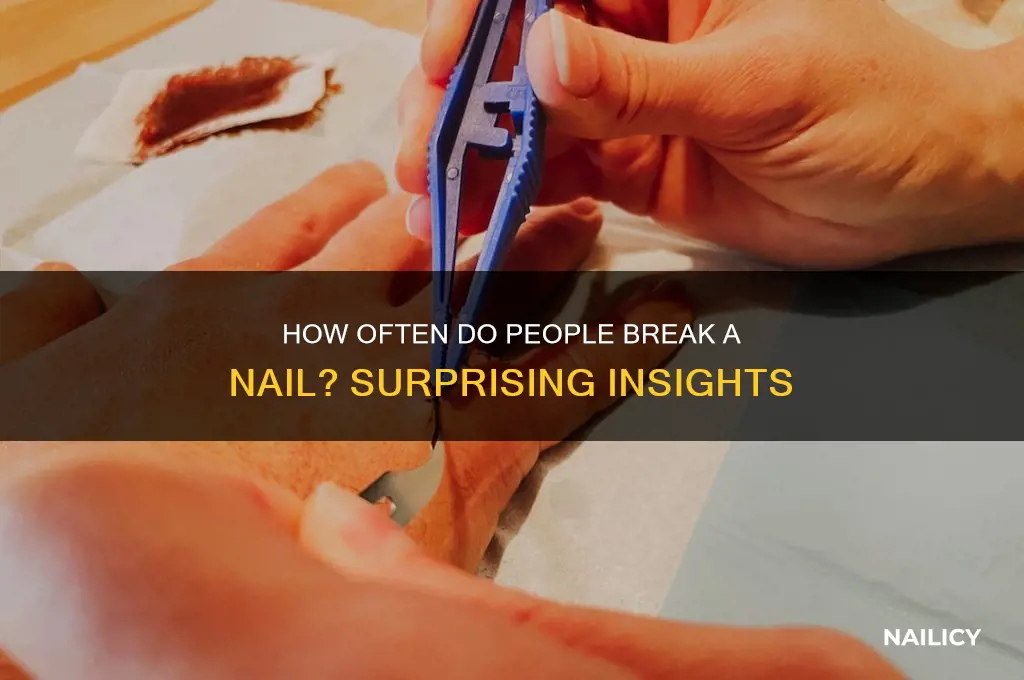 How Often Do People Break A Nail? Surprising Insights | Nailicy