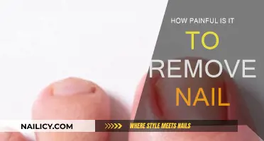 Toe Nail Removal: A Step-By-Step Guide | Nailicy