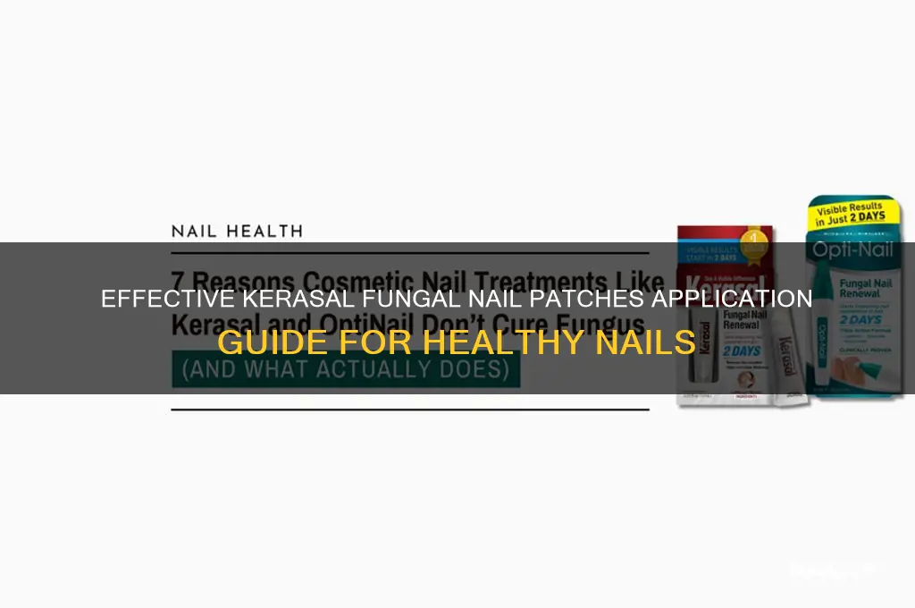 Effective Kerasal Fungal Nail Patches Application Guide For Healthy ...