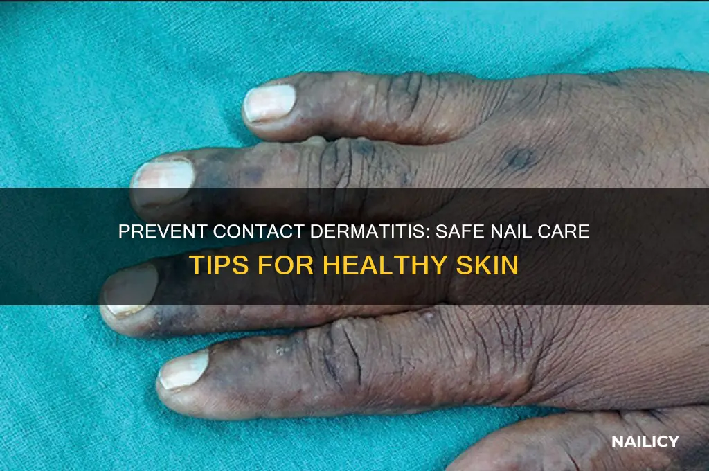 Prevent Contact Dermatitis: Safe Nail Care Tips For Healthy Skin | Nailicy