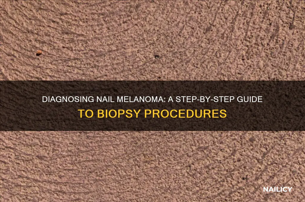 Diagnosing Nail Melanoma: A Step-By-Step Guide To Biopsy Procedures ...