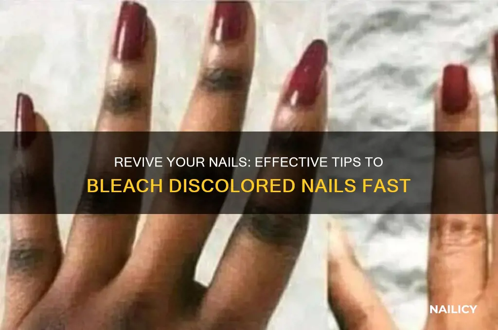 Revive Your Nails: Effective Tips To Bleach Discolored Nails Fast | Nailicy