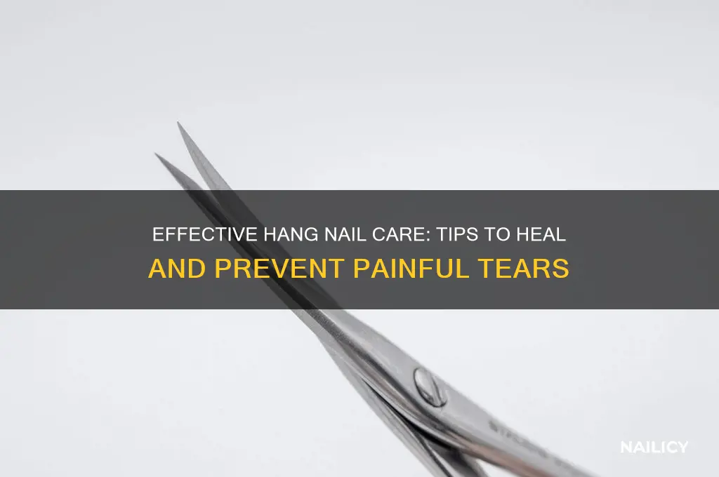 Effective Hang Nail Care: Tips To Heal And Prevent Painful Tears | Nailicy
