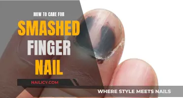 Heal Your Split Fingernail: Quick And Easy Home Remedies | Nailicy