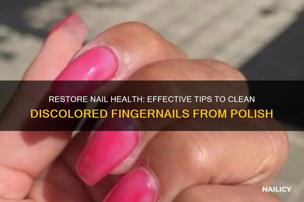 Restore Nail Health: Effective Tips To Clean Discolored Fingernails ...
