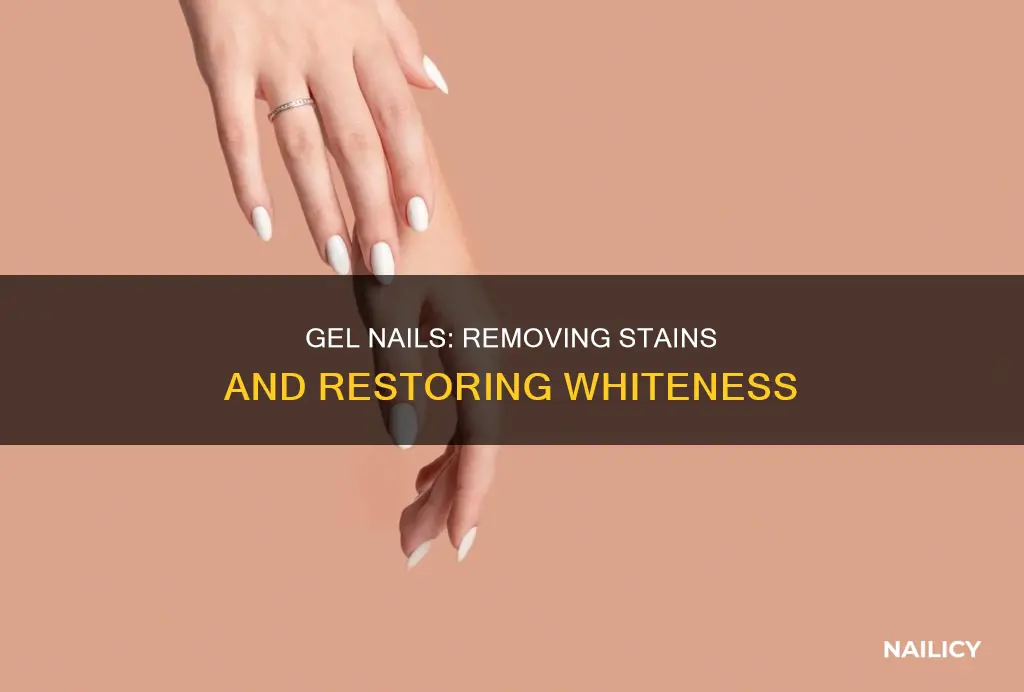 Gel Nails: Removing Stains And Restoring Whiteness | Nailicy