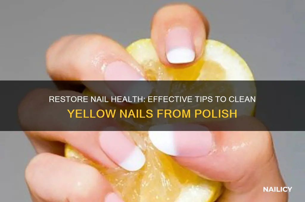 Restore Nail Health: Effective Tips To Clean Yellow Nails From Polish ...