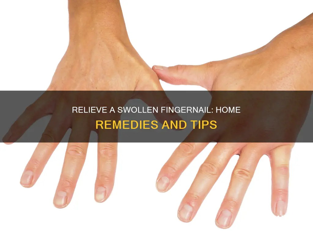 Relieve A Swollen Fingernail: Home Remedies And Tips | Nailicy