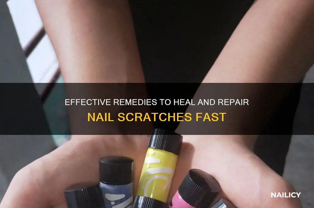 Effective Remedies To Heal And Repair Nail Scratches Fast | Nailicy