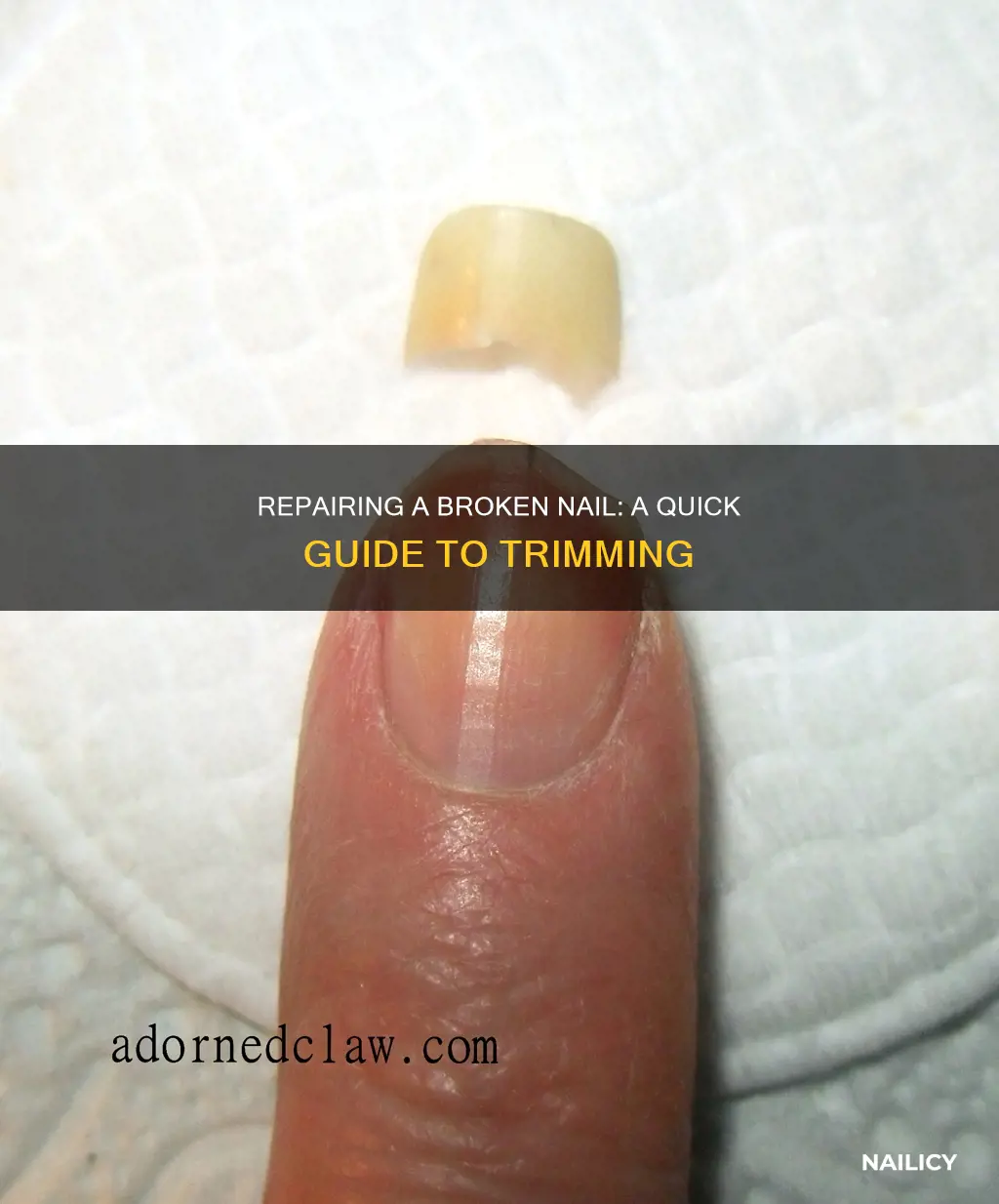 Repairing A Broken Nail: A Quick Guide To Trimming | Nailicy