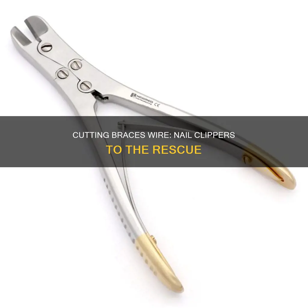 Cutting Braces Wire: Nail Clippers To The Rescue | Nailicy