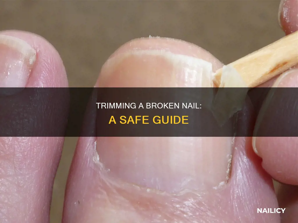 Trimming A Broken Nail: A Safe Guide | Nailicy