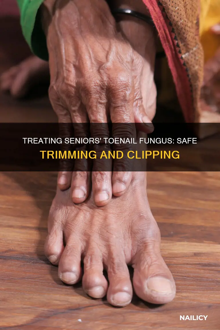 Treating Seniors' Toenail Fungus: Safe Trimming And Clipping | Nailicy