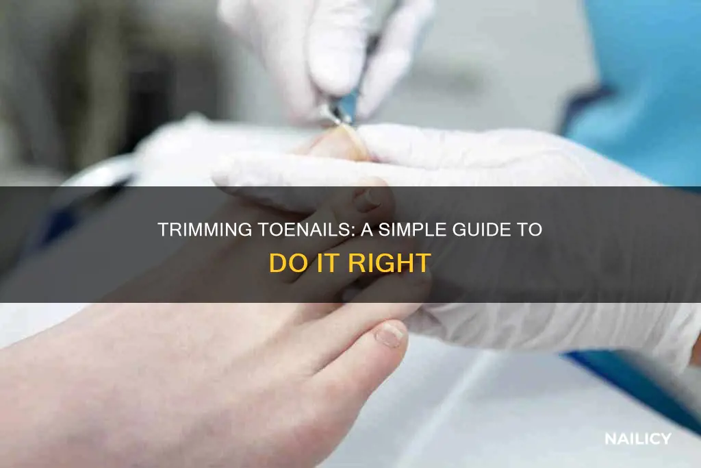 Trimming Toenails: A Simple Guide To Do It Right | Nailicy