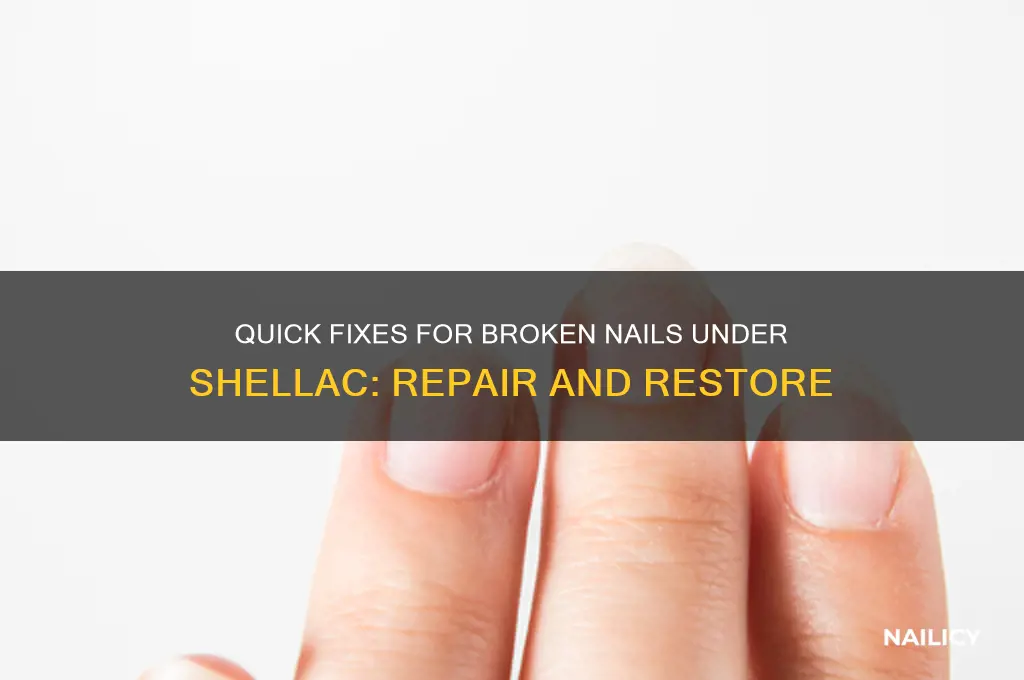 Quick Fixes For Broken Nails Under Shellac: Repair And Restore | Nailicy