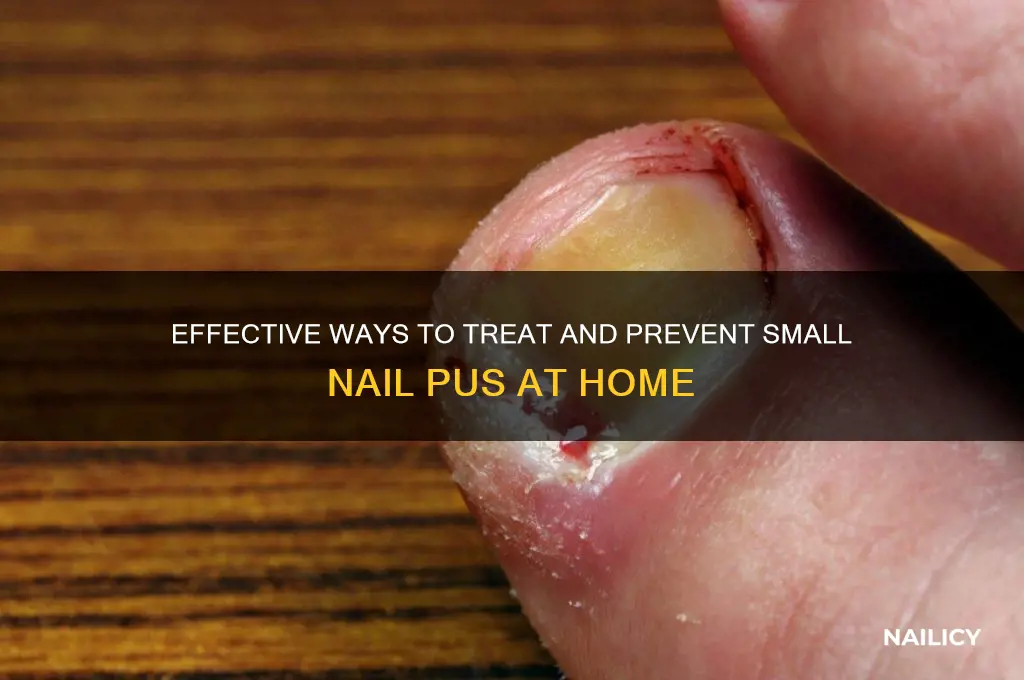 Effective Ways To Treat And Prevent Small Nail Pus At Home | Nailicy