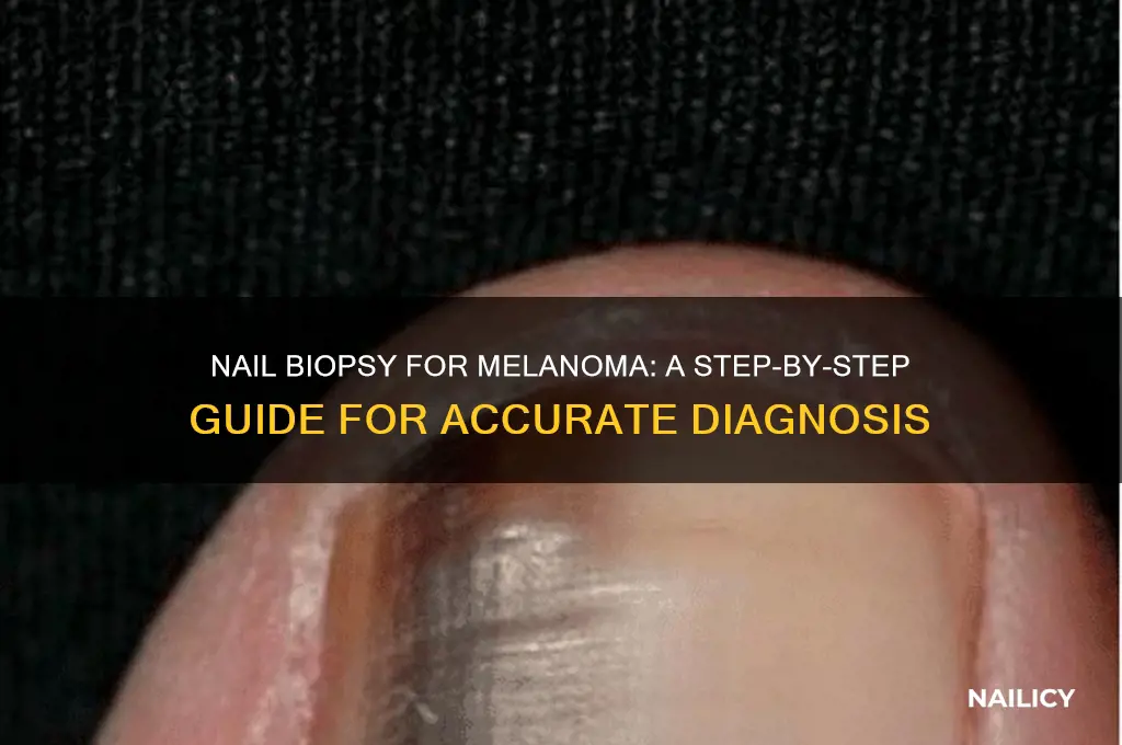 Nail Biopsy For Melanoma: A Step-By-Step Guide For Accurate Diagnosis ...