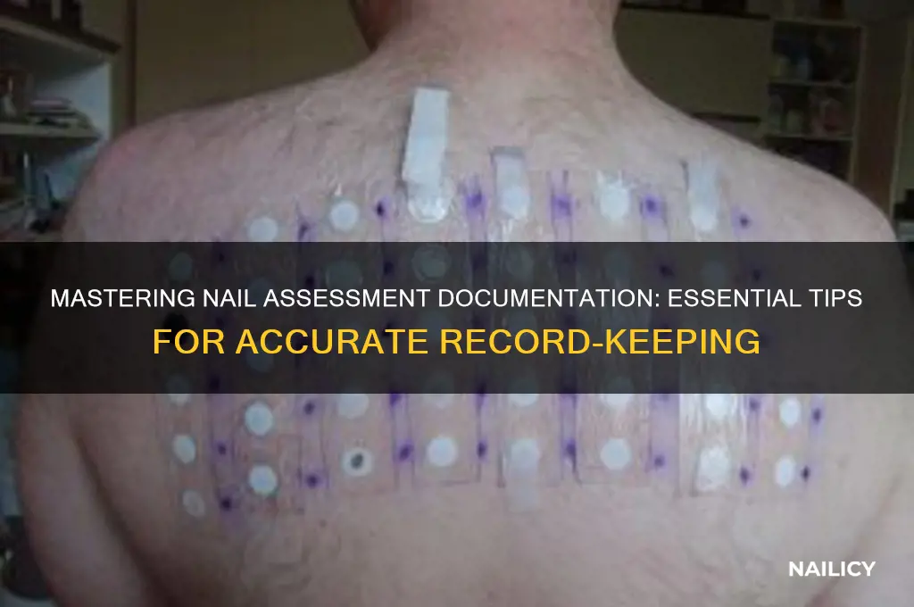 Mastering Nail Assessment Documentation: Essential Tips For Accurate ...