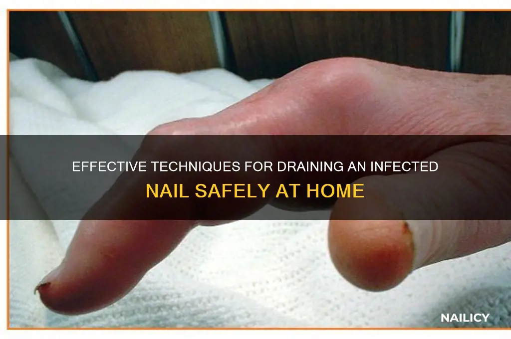 Effective Techniques For Draining An Infected Nail Safely At Home | Nailicy