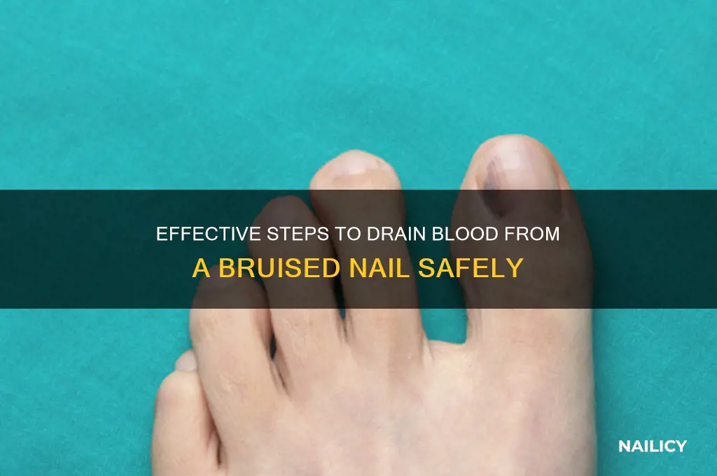 Effective Steps To Drain Blood From A Bruised Nail Safely | Nailicy