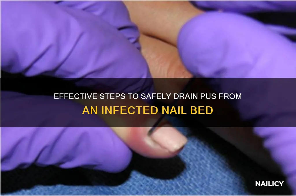 Effective Steps To Safely Drain Pus From An Infected Nail Bed | Nailicy
