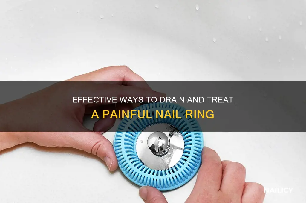 Effective Ways To Drain And Treat A Painful Nail Ring | Nailicy