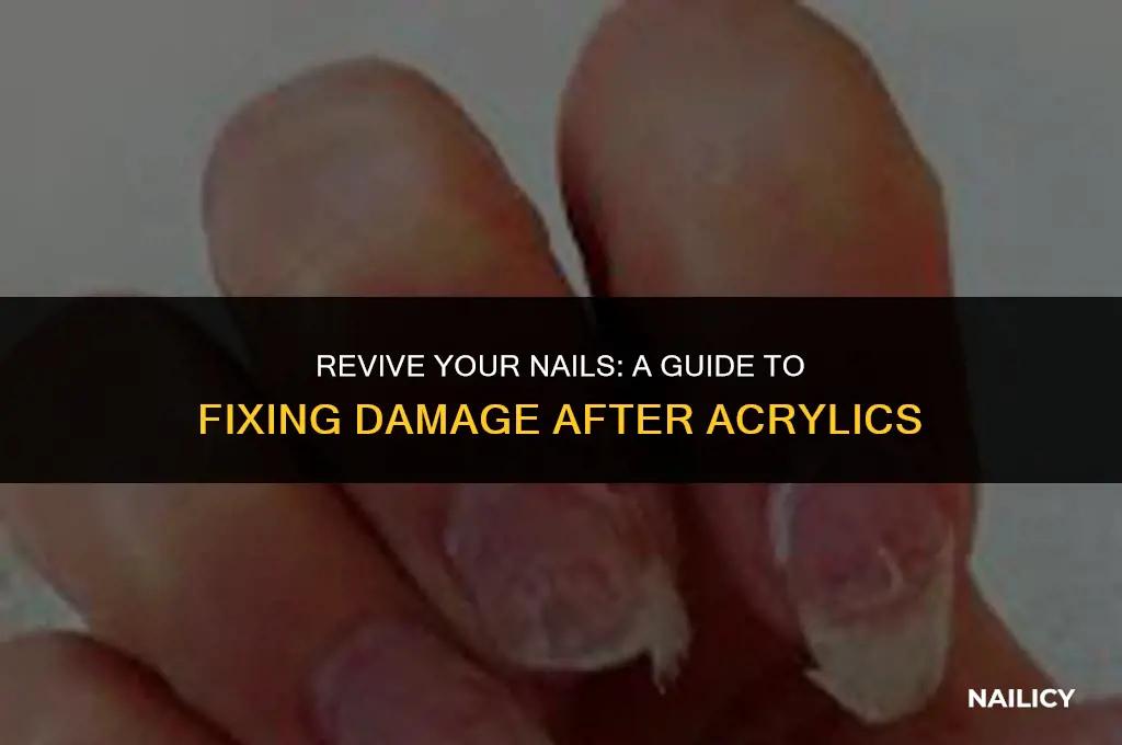 Revive Your Nails: A Guide To Fixing Damage After Acrylics | Nailicy