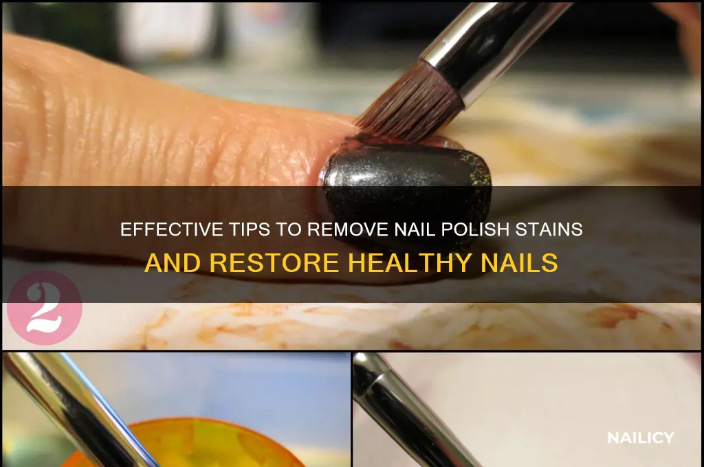 Effective Tips To Remove Nail Polish Stains And Restore Healthy Nails ...