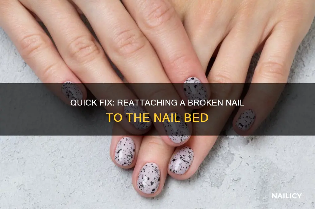 Quick Fix: Reattaching A Broken Nail To The Nail Bed | Nailicy