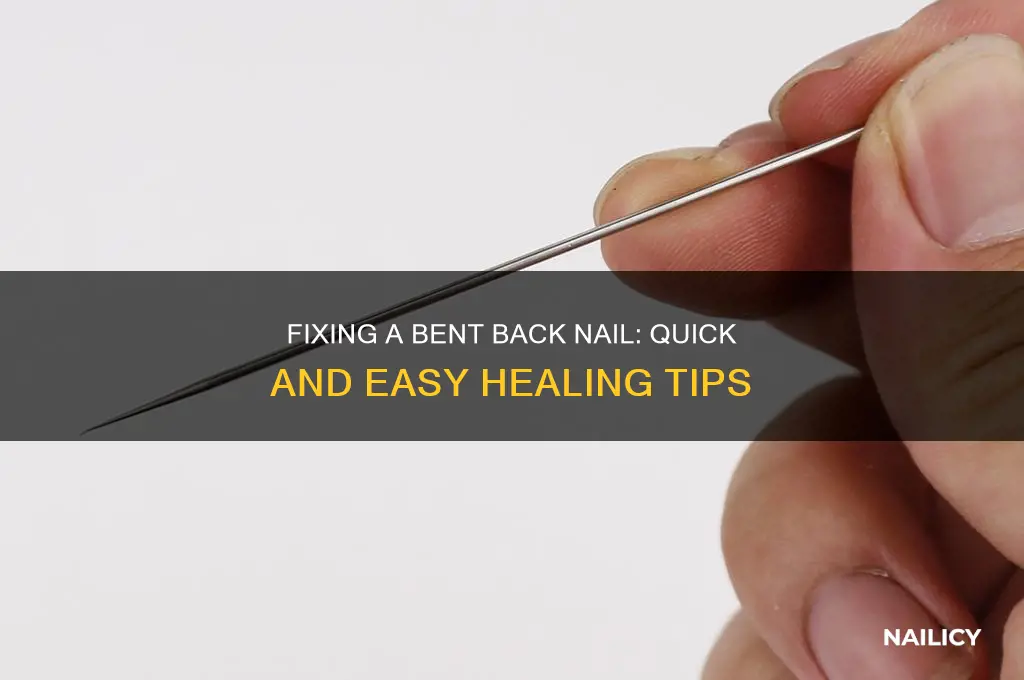 Fixing A Bent Back Nail: Quick And Easy Healing Tips | Nailicy